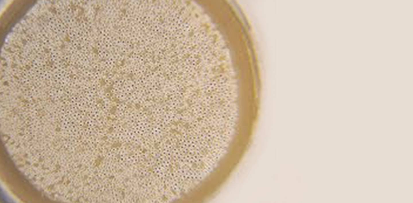 FAQs About Nephros Dual-Stage Infection Control Filters | Nephros