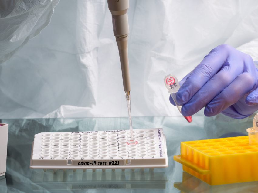 Water Filtration Solutions | Nephros