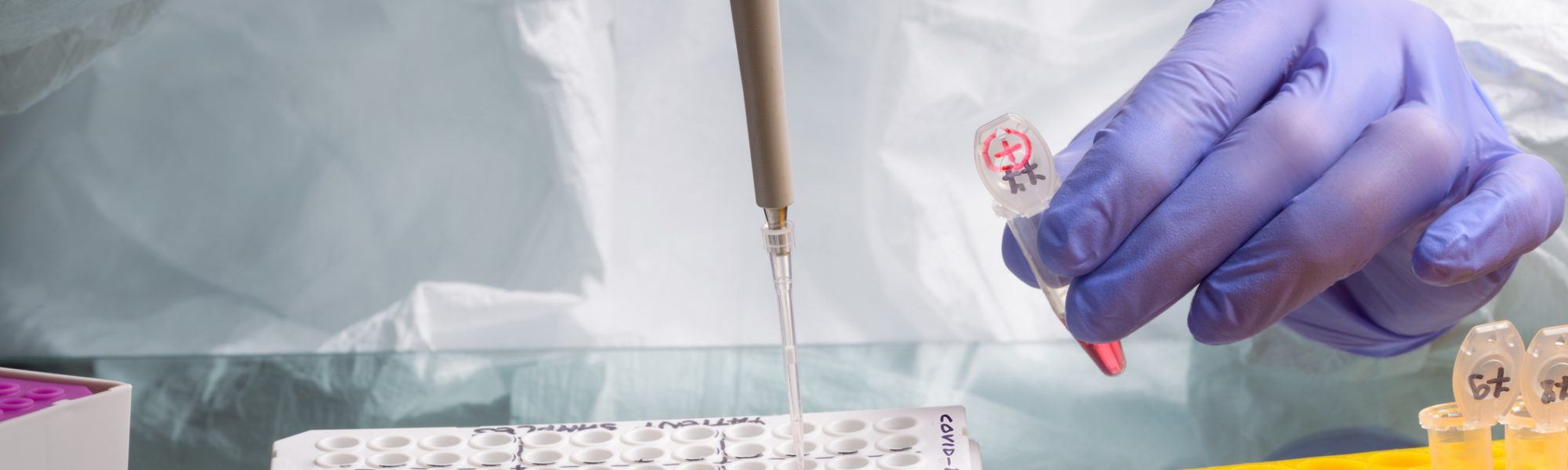 Nephros Has Agreed to Sell Our Pathogen Detection Business